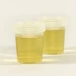 Why is My Pee Bright Yellow? | Rose Wellness